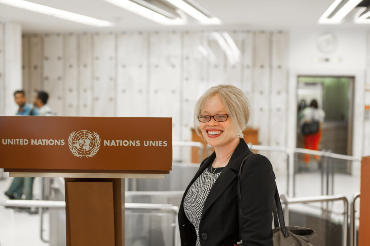 History - Africa Albinism Network