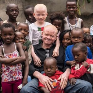 Homepage - Africa Albinism Network