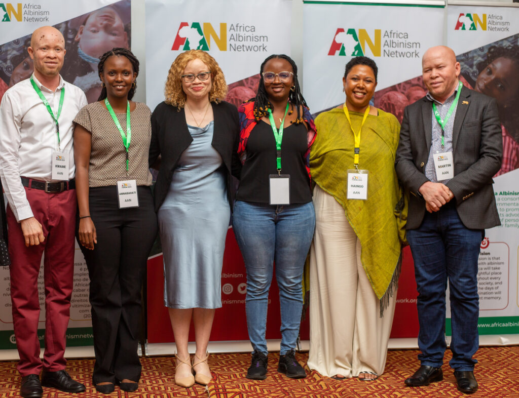History - Africa Albinism Network