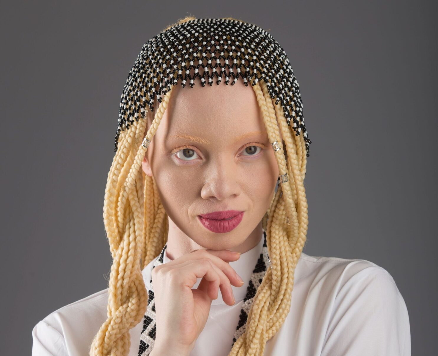 Newsletter (October – December 2023) - Africa Albinism Network