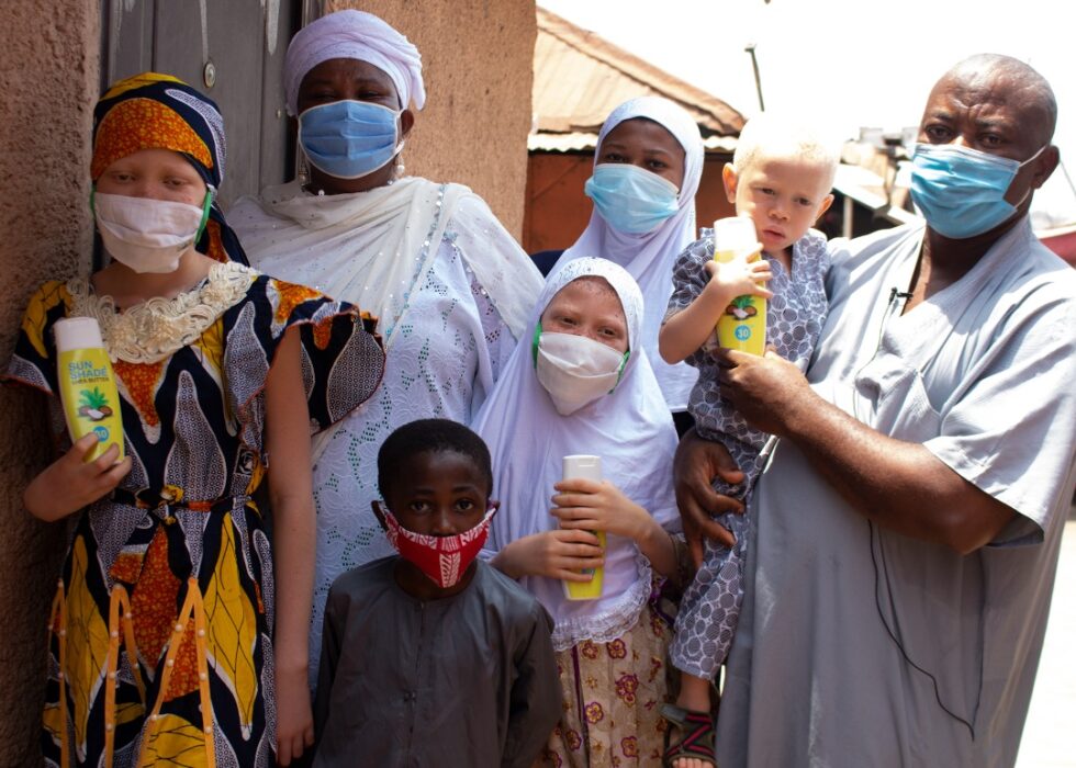 Shining Light on the Invisible Battle: Skin Cancer and Albinism in ...