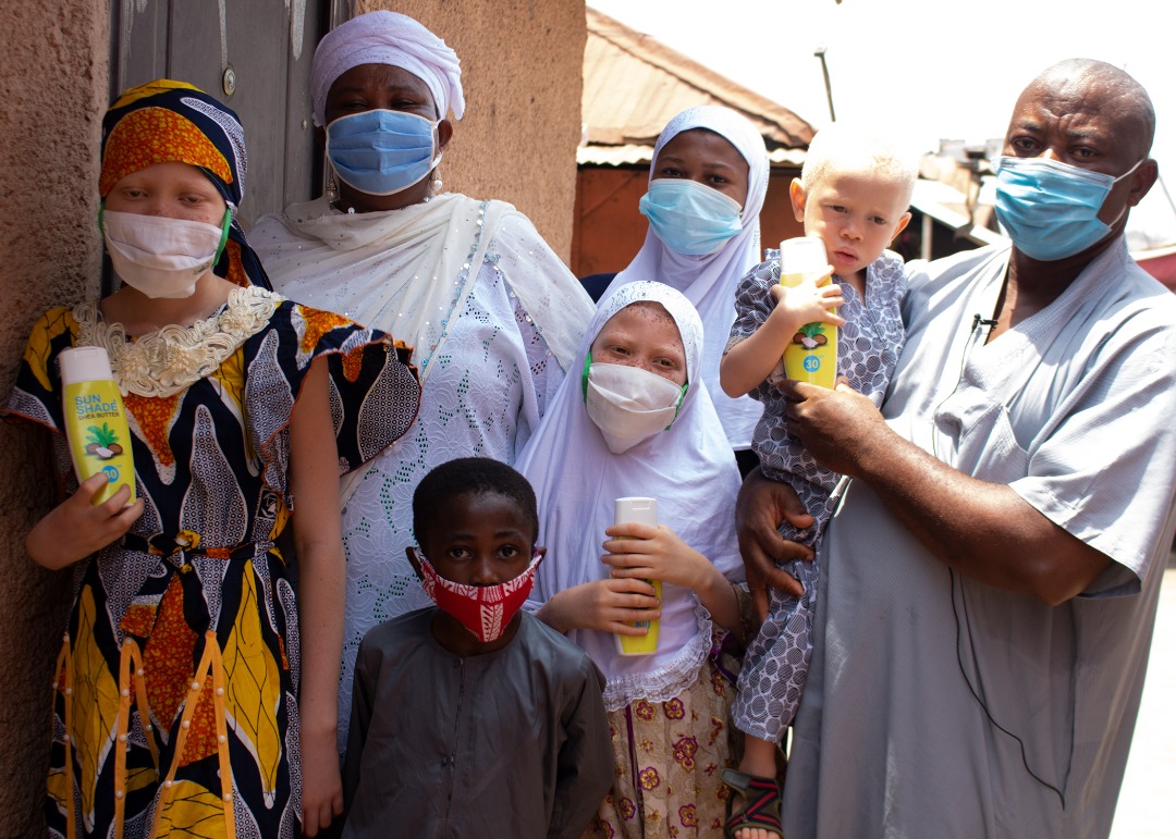 Shining Light on the Invisible Battle: Skin Cancer and Albinism in ...