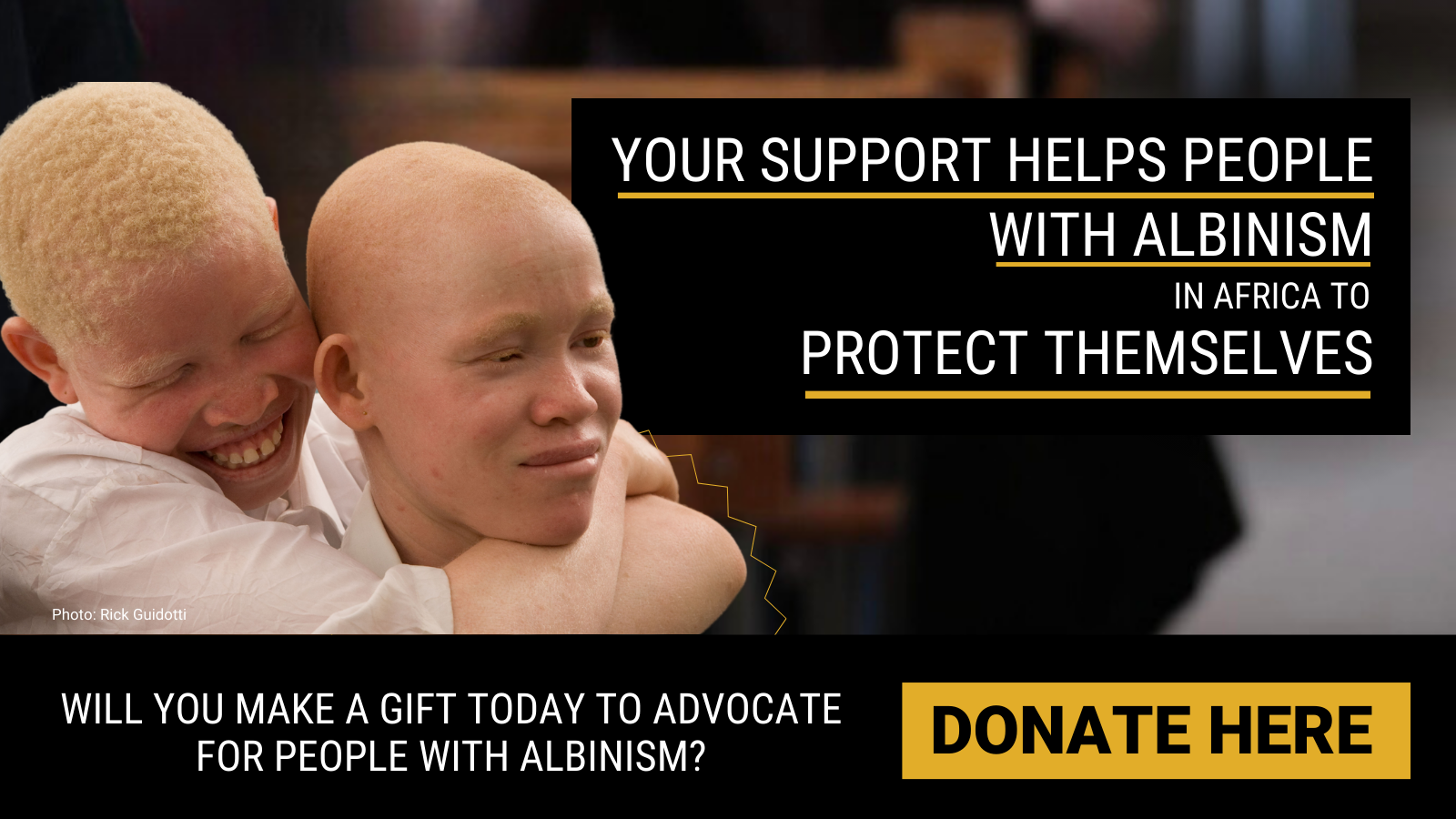 Celebrating 10 Years of Albinism Days! - Africa Albinism Network